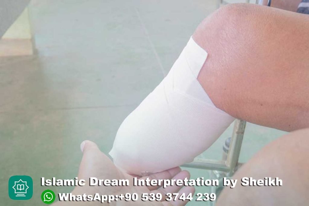 Dreaming of Someone Elseʼs Legs Cut Off in Islam | Best Istikhara